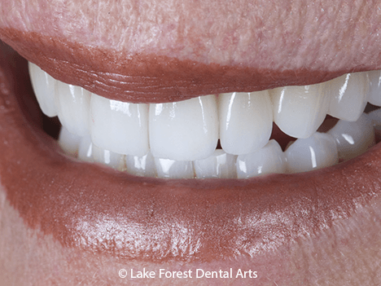 Design Your Smile: Step by step process to meet smile goals