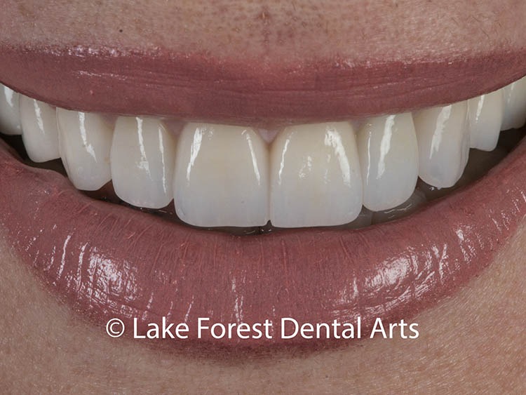 Best Smile | Consider investing in cosmetic dentistry