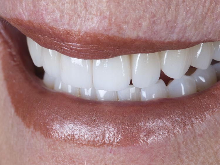 Enhance your smile | Most common treatment options